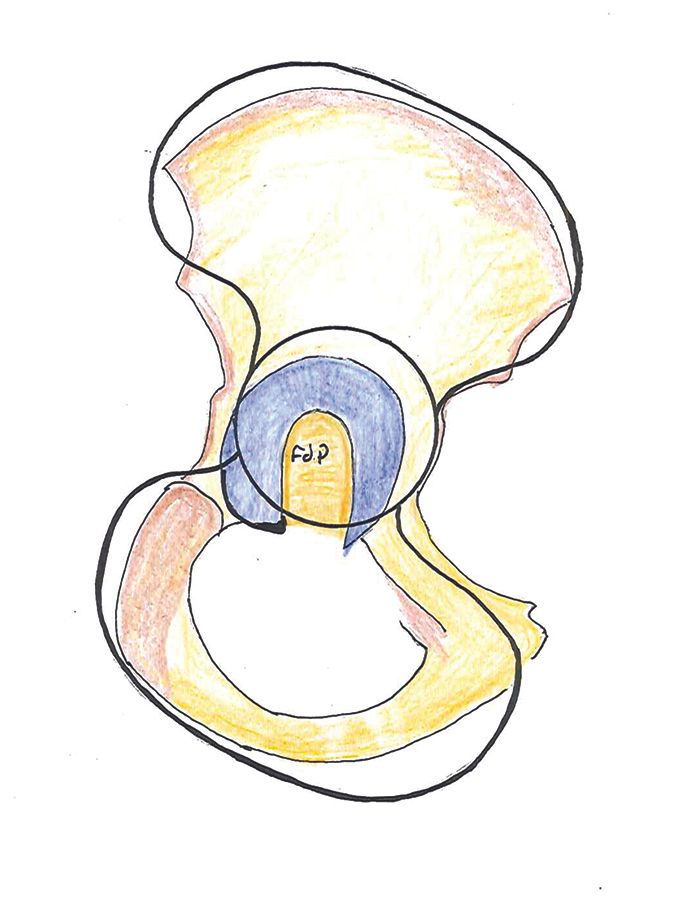 Anatomie chirurgicale de l'os coxal