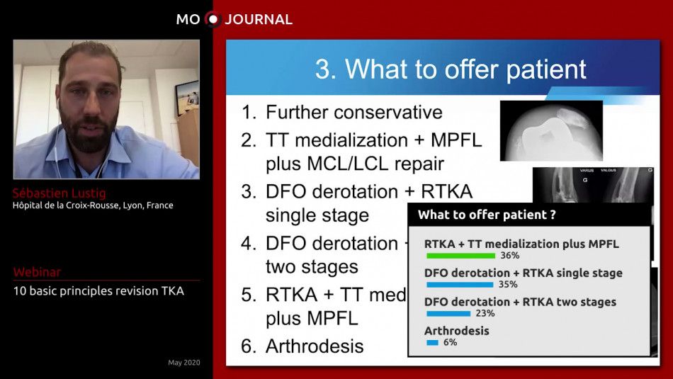 10 Basic principles for Revision TKA