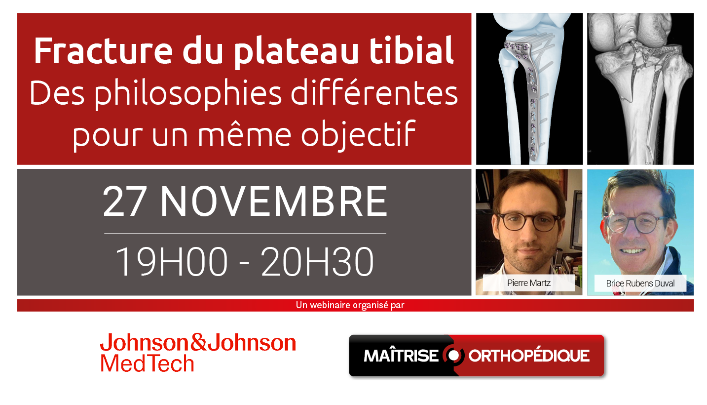 Fracture du plateau tibial : des philosophies différentes pour un même ...