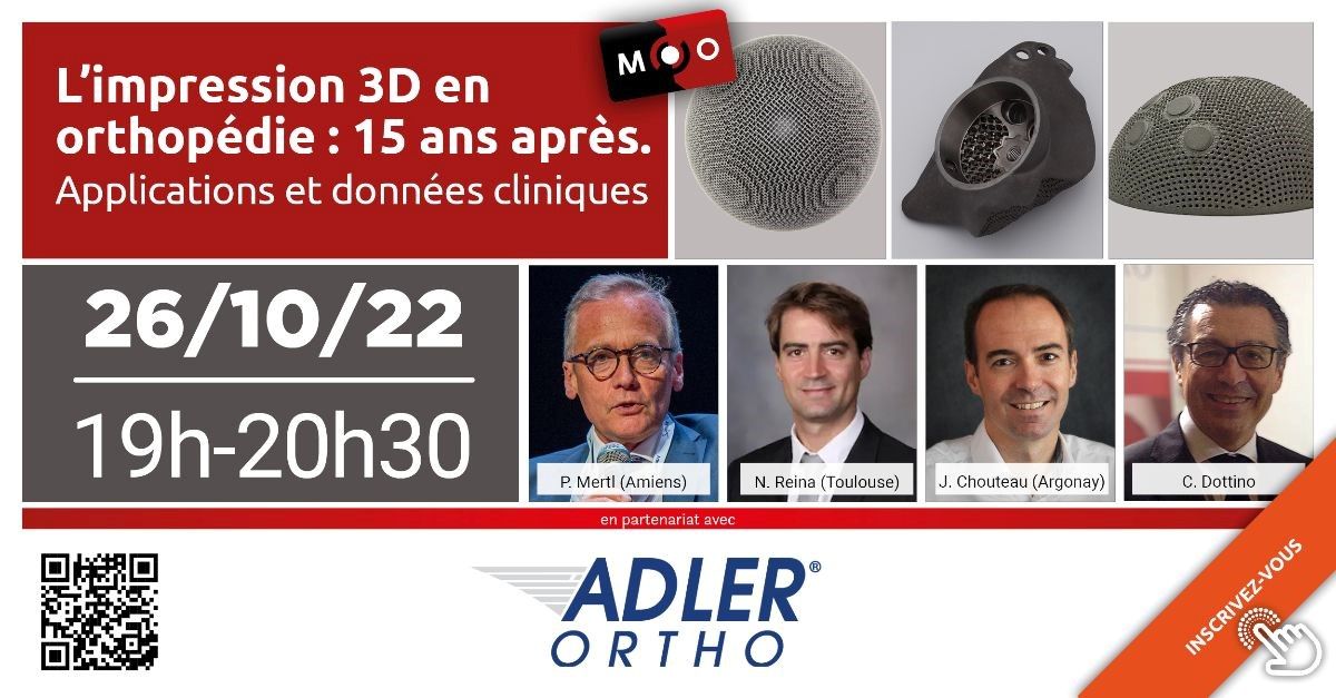 Le pivot Wagner Cone : un implant "niche" peu connu... - Etude clinique ...